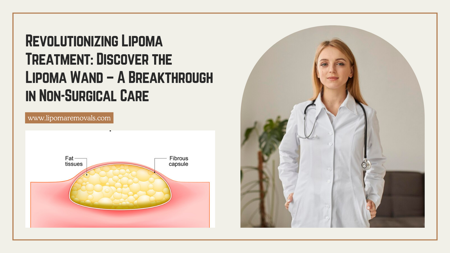 Revolutionizing Lipoma Treatment: Discover the Lipoma Wand – A Breakth ...
